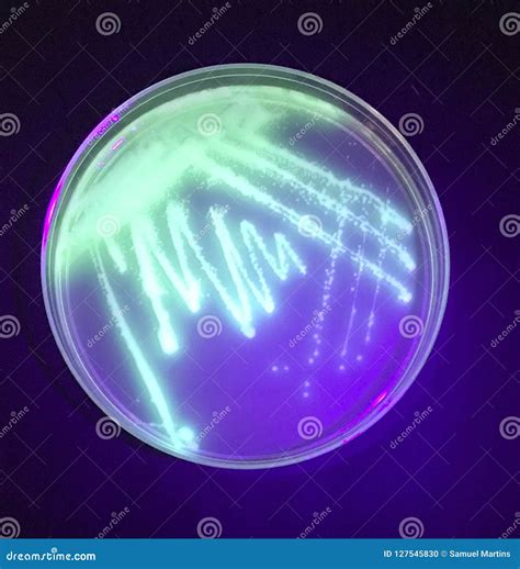 Uv Light Effect On Bacteria At Johnathan Olivar Blog
