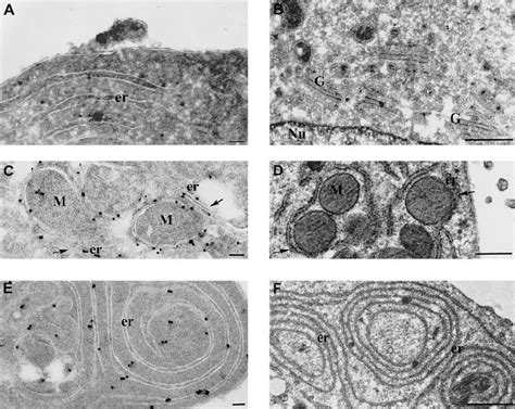 Immunogold Localization Of Ns Proteins In Hbi10a Cells A B C E
