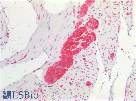 Pathplus™ Mapt Tau Polyclonal Antibody Rabbit Anti Human Ihc Lsbio