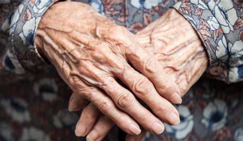 How To Protect Fragile Skin