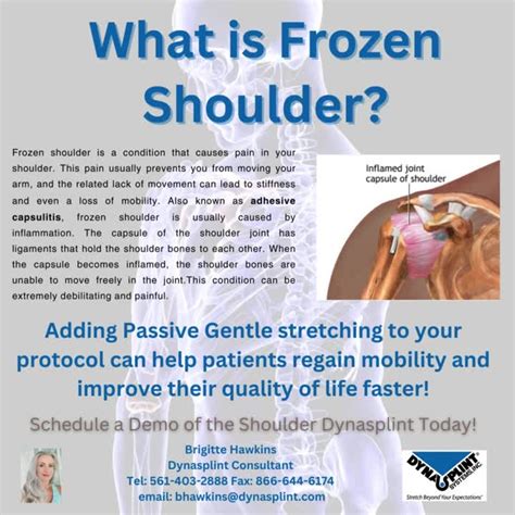 How The Shoulder Dynasplint System Can Ease Pain Brigitte Hawkins Posted On The Topic Linkedin How The Shoulder Dynasplint System Can Ease Pain Brigitte Hawkins Posted On The Topic Linkedin