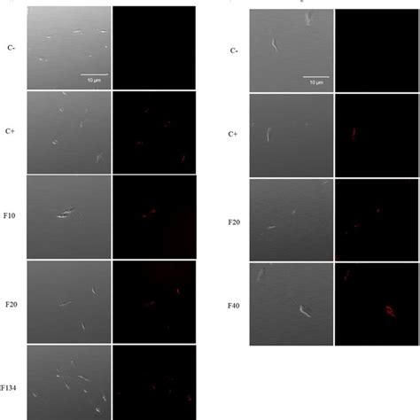 Cellrox Deep Red Staining Results After 24 H Of Incubation With The Ic