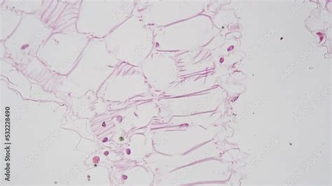 Matuer Anther Of Lilium In Transversal Section Under Microscope 200x On
