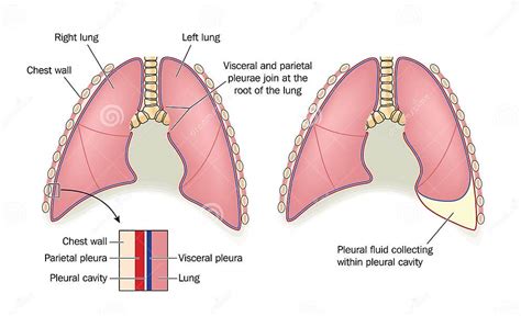 Pleural Membranes And Fluid Stock Illustration Illustration Of