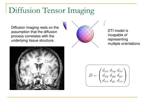 Ppt On Computing The Underlying Fiber Directions From The Diffusion Orientation Distribution
