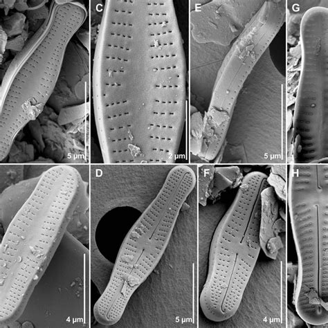 Achnanthidium Species Lm Micrographs A M Achnanthidium