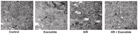 Effects Of Exenatide On Mitochondrial Morphology In H9c2 Cells H9c2