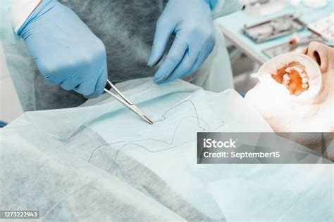 임플란트 배치 작업 중 환자와 치과 의사 실제 작동 치아 추출 임플란트 전문 유니폼과 치과 의사의 장비 의료 는 의사 작업장