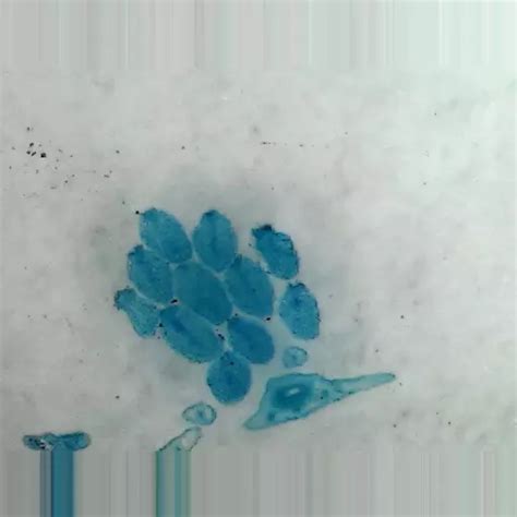 Microscope Slide Ranunculus Ls Flower