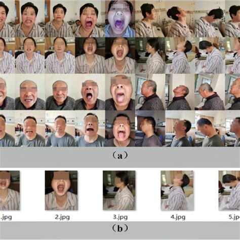 Five Fold Cross Validation The Dataset Is Divided Into Five Folds Download Scientific Diagram