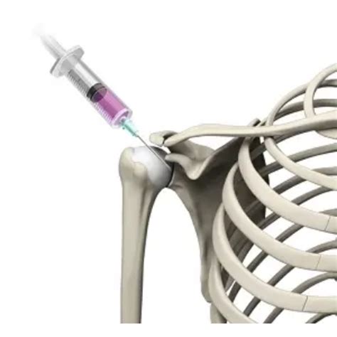 Subacromial Space Dr Abhinav Mishra