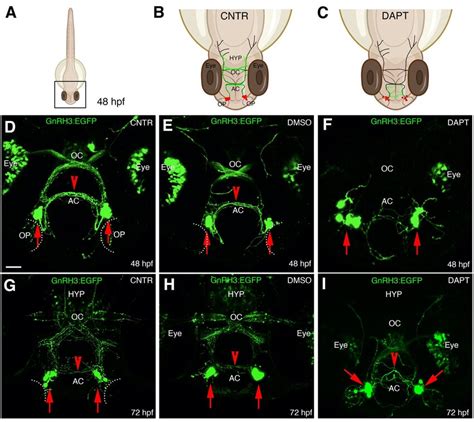 Dapt Treatment Affects The Localization Of Gnrh3 Neurons And Their Download Scientific Diagram