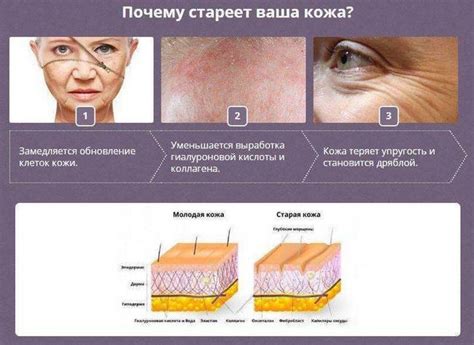Коллост микро (Collost micro). Отзывы, цена процедуры, инструкция