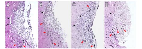 Histology Normal Trabecular Meshwork Tm A Was A Multilayer