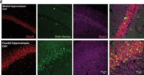 Map2 Antibody Bsa Free Nb300 213 By Novus Part Of Bio Techne