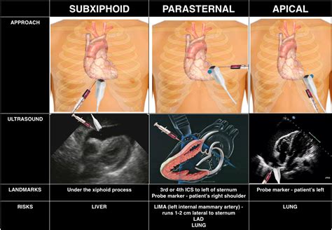 Episode 54 The Pericardium Foamcast