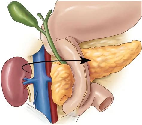 The Duodenum Diseases Symptoms Treatment Diet Health