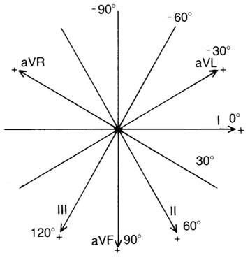 EKG Quiz Flashcards Quizlet