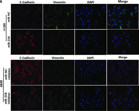 Mir 218 Negatively Regulated The Migration Invasion And Emt Of Nsclc