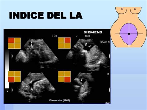 Ppt Liquido Amniotico Powerpoint Presentation Free Download Id6733932