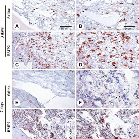 Femoral Segmental Defect Model A Schematic Diagram Depicting Use Of Download Scientific