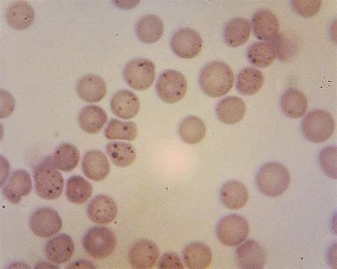 ClÍnica Veterinaria Norton Dr Marcelo Cando Mycoplasma Haemofelis