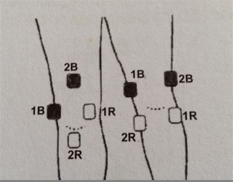 24 Best Images About Tens Unit Placement Charts On Pinterest Massage