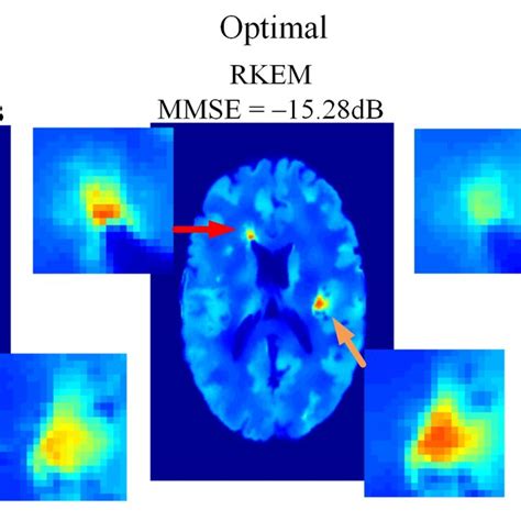 Effect Of Regularization Coefficient β On Rkem Image Quality Download