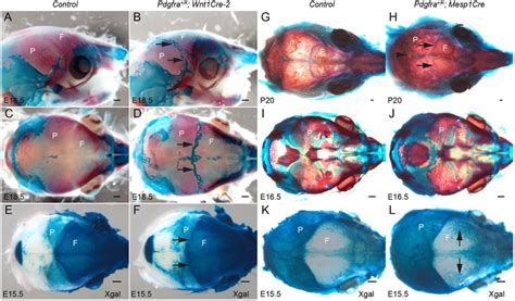 Activation Of Pdgfrα In Neural Crest Cells Or In Mesoderm Gives Rise To Download Scientific