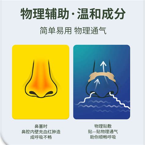 Made In Huabei Ventilation Nasal Patch Nasal Soothing Patch Expansion