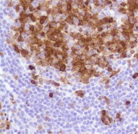 Stathmin 1 Monoclonal Antibody Sp49 Invitrogen™ 500 μl Unconjugated