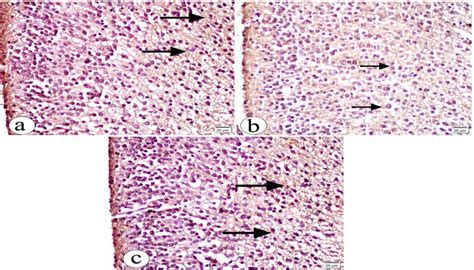 The Photomicrographs Of The Sections In The Medial Prefrontal Cortex Of Download Scientific