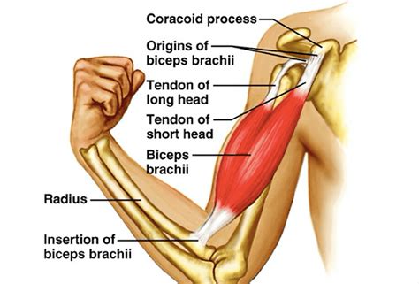 Biceps Tendonitis