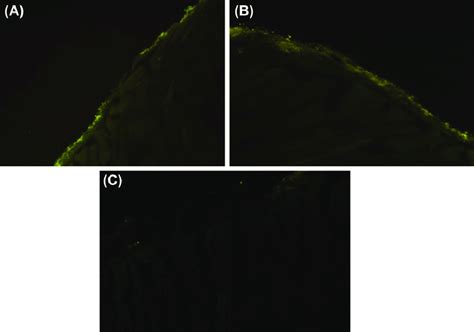The Immunofluorescence Microscope Images Show The Peritoneum Slides