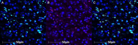 Improving Multiplex If Image Analysis Workflows Does The Perfect