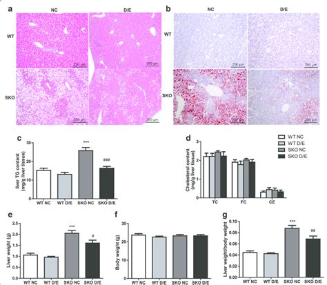 The Improvement Of Hepatic Lipid Accumulation Of Sko Mice After De