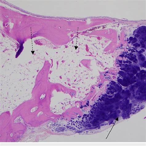 Histologic Appearance Of Hematoxylin And Eosin Stained Specimen Showing
