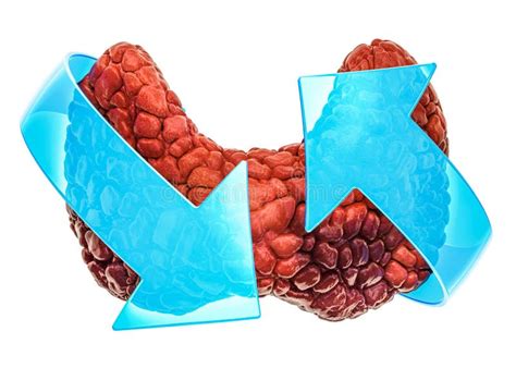 Human Thyroid With Shackle Thyroid Disease Concept Stock Illustration