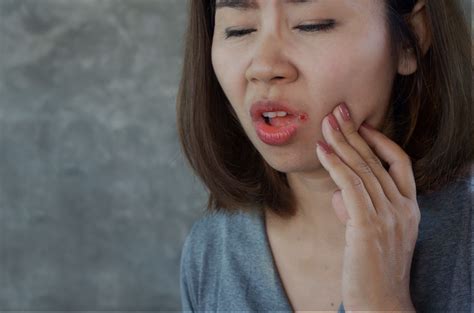 Angular Cheilitis Treatment Cure Causes Symptoms More Cult Fit
