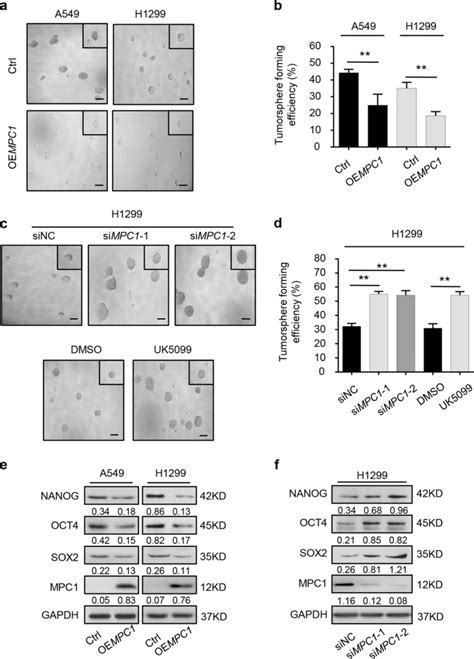 Mpc1 Deficiency Accelerates Lung Adenocarcinoma Progression Through The