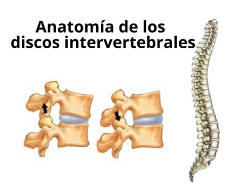 Disco Intervertebral Degenerative Disc Disease Causes And Treatment
