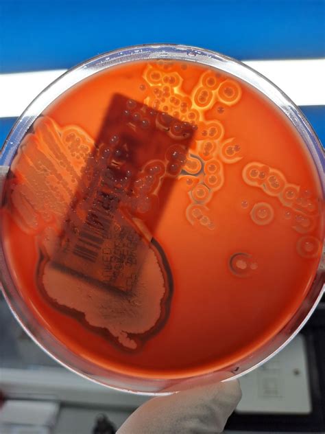 How S Aureus And S Epidermidis Strains Produce Hemolysis Whats