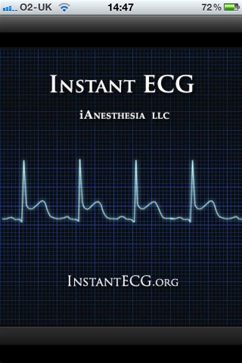 Instant Ecg Still One Of The Most Comprehensive Ecg Apps