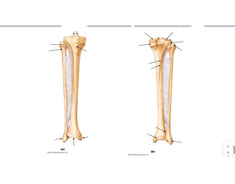 Fibia And Tibia Quiz