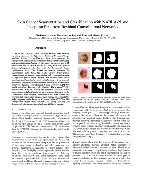 Skin Cancer Segmentation And Classification With Nabla N And Inception