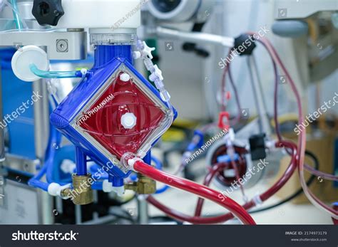 Extracorporeal Membrane Oxygenation Machine