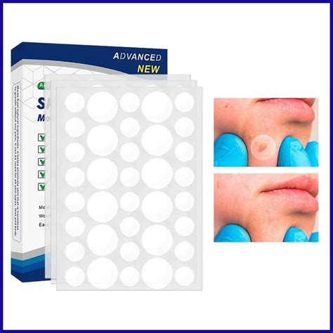 Natural Wart Removal Patches Pcs Box Skin Tags Remover Tool Body Tags Removers Mole Warts