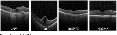 Figure 6 From A Deep Learning Based Framework For Retinal Disease