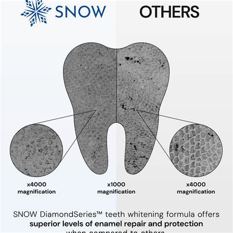 Whats The Difference Between Stannous Fluoride And Sodium Fluoride Snow® Oral Care