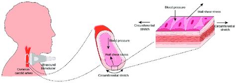 Hemodynamic Parameters Of The Common Carotid Artery Download Scientific Diagram